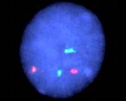 APL – FISH (Dx) – Cancer Genetics and Genomics Laboratory