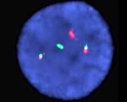 APL – FISH (Dx) – Cancer Genetics and Genomics Laboratory