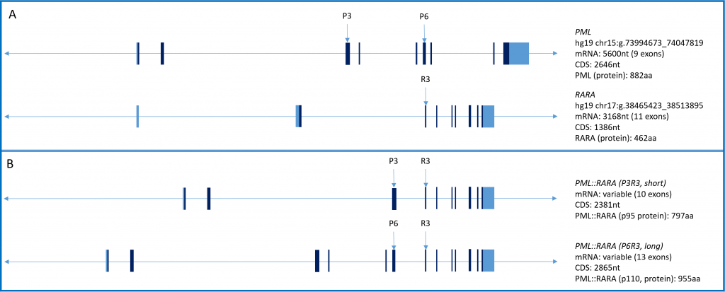 Acute Promyelocytic Leukemia (APL) – Cancer Genetics and Genomics ...