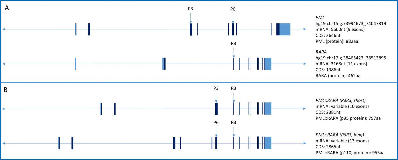 Acute Promyelocytic Leukemia (APL) – Cancer Genetics and Genomics ...