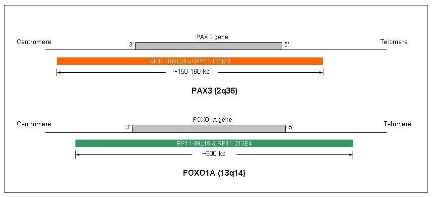 Alveolar Rhabdomyosarcoma (ARMS) - Cancer Genetics and Genomics Laboratory